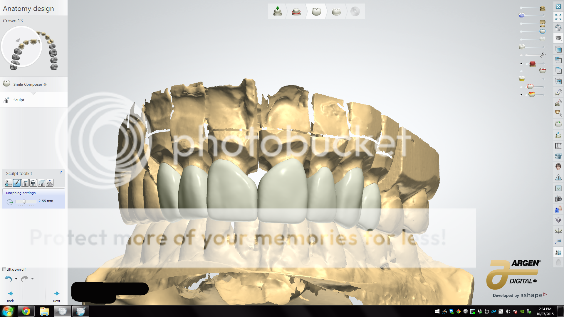 Zirconia Framework Design | Dental Lab Network