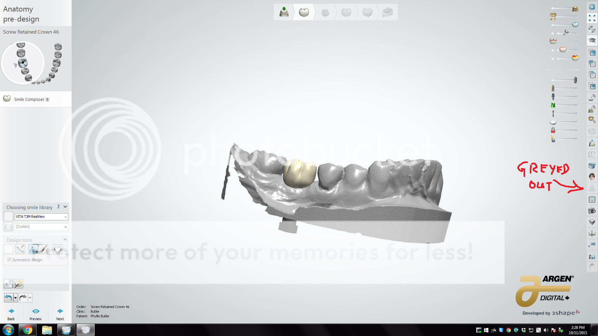 Nobel and 3shape validation error | Dental Lab Network