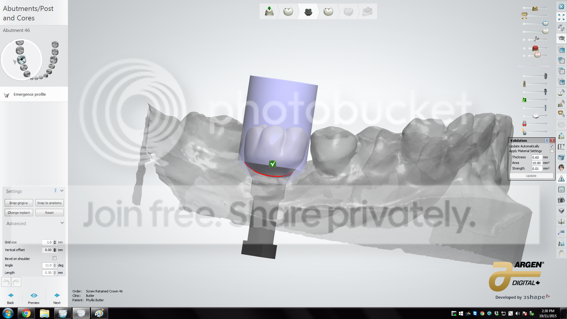 Nobel and 3shape validation error | Dental Lab Network