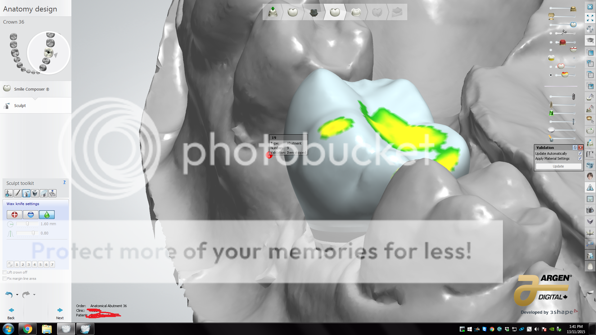 Nobel and 3shape validation error | Dental Lab Network